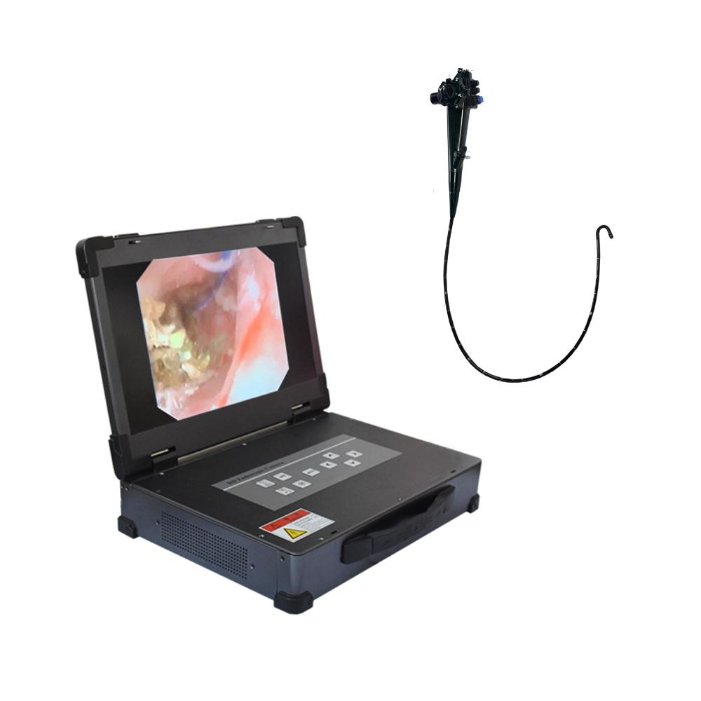 Electronic Gastroscope - 233 (HENAN) TRADING CO., LTD.