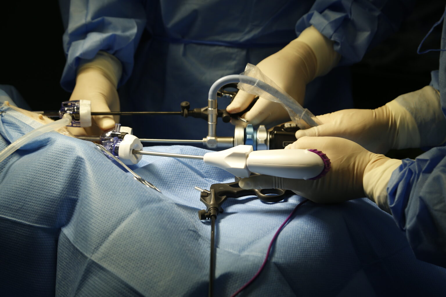 LigaSure Technology in Hemorrhoid Surgery - 233 (HENAN) TRADING CO., LTD.